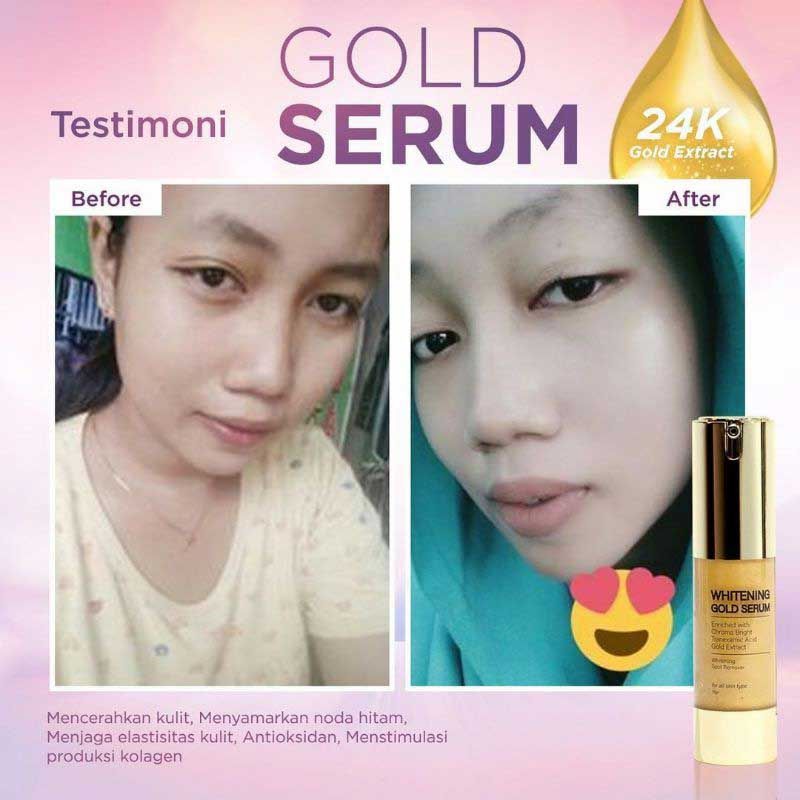 Serum gold ms glow store